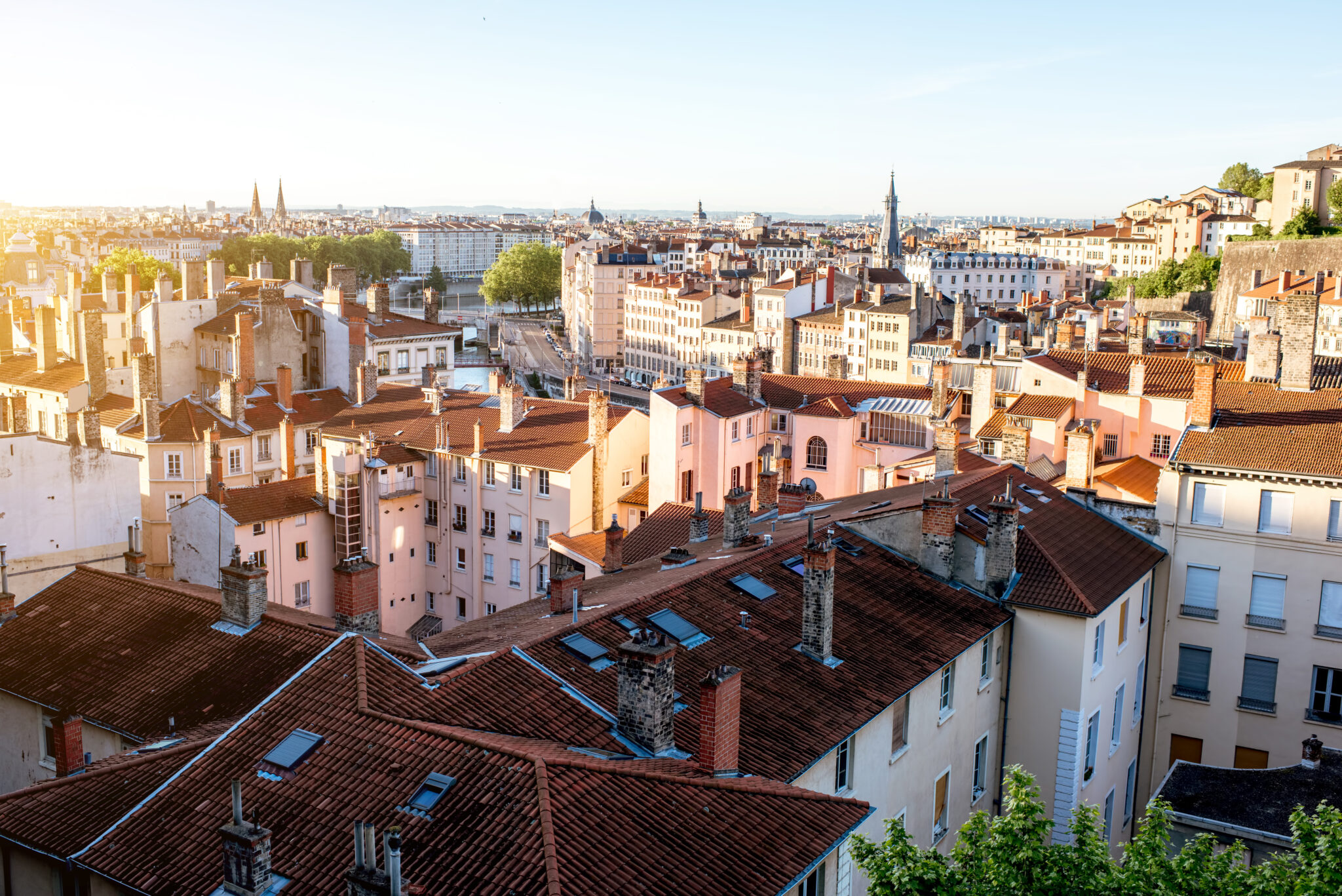 Où passer une IRM rapidement à Lyon ? | LYON CONNECT